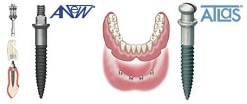 Dentatus Posts | Dentatus