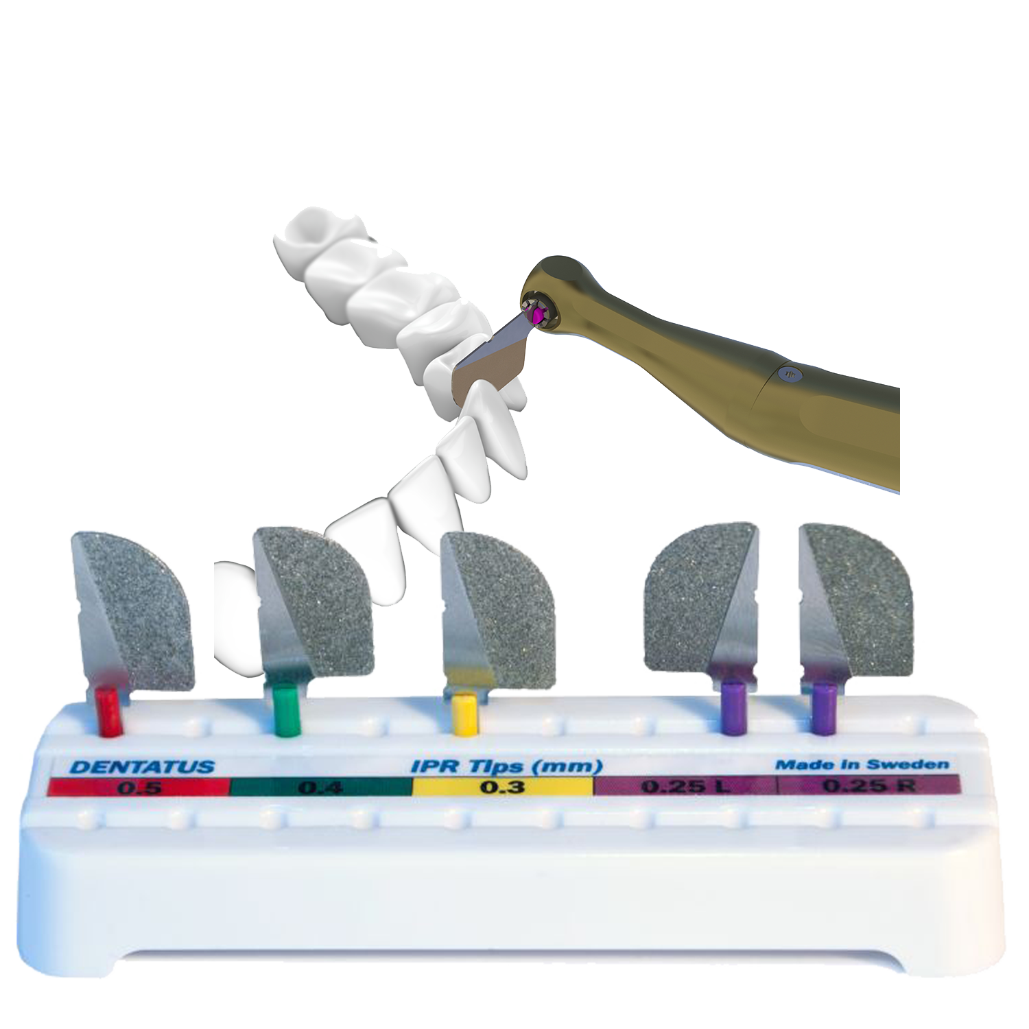 IPR | Dentatus