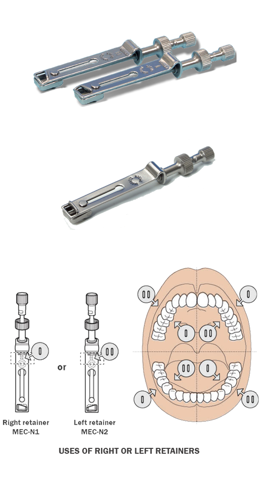 Retainers | Dentatus